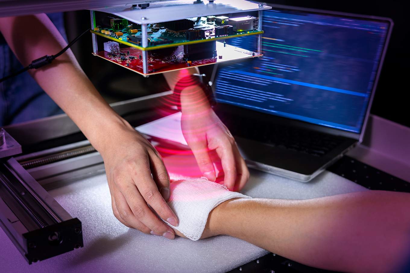 AI Technology Monitors Wounds Under Bandages - University at Buffalo